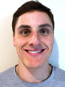 Bottle Openers – EPICS